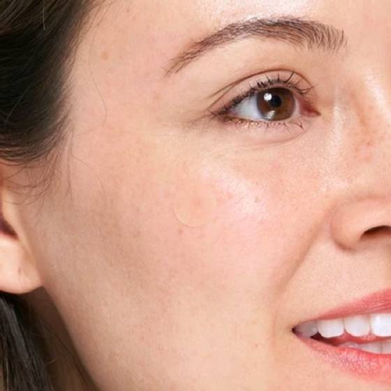 Pimple Correct | Hero Cosmetics