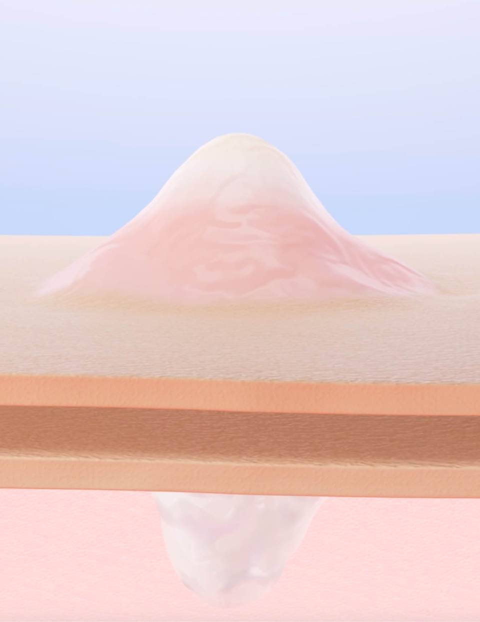 Everything You Need to Know About Comedonal Acne