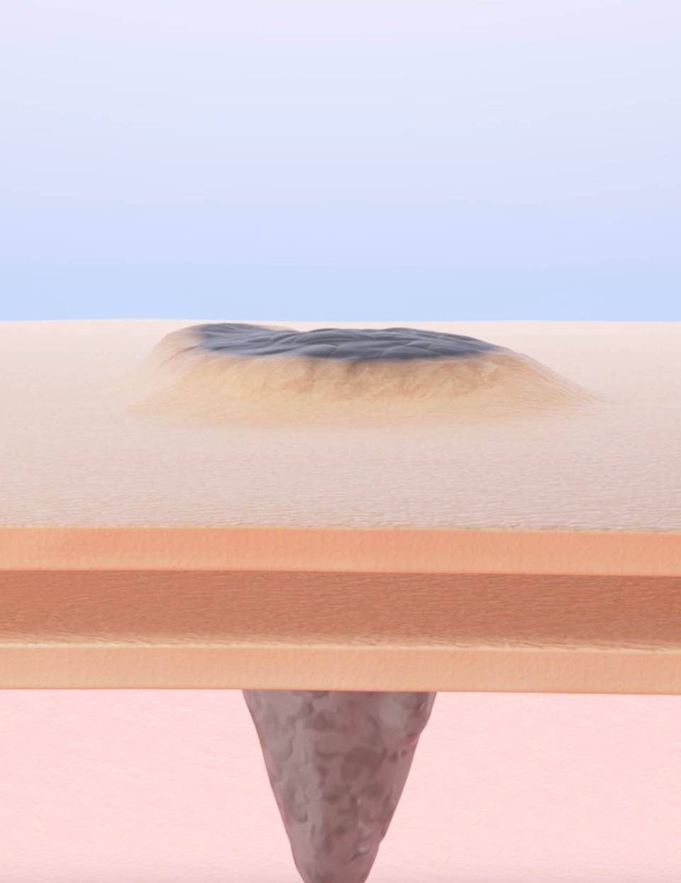 Everything You Need to Know About Comedones | Journal | Vida Glow