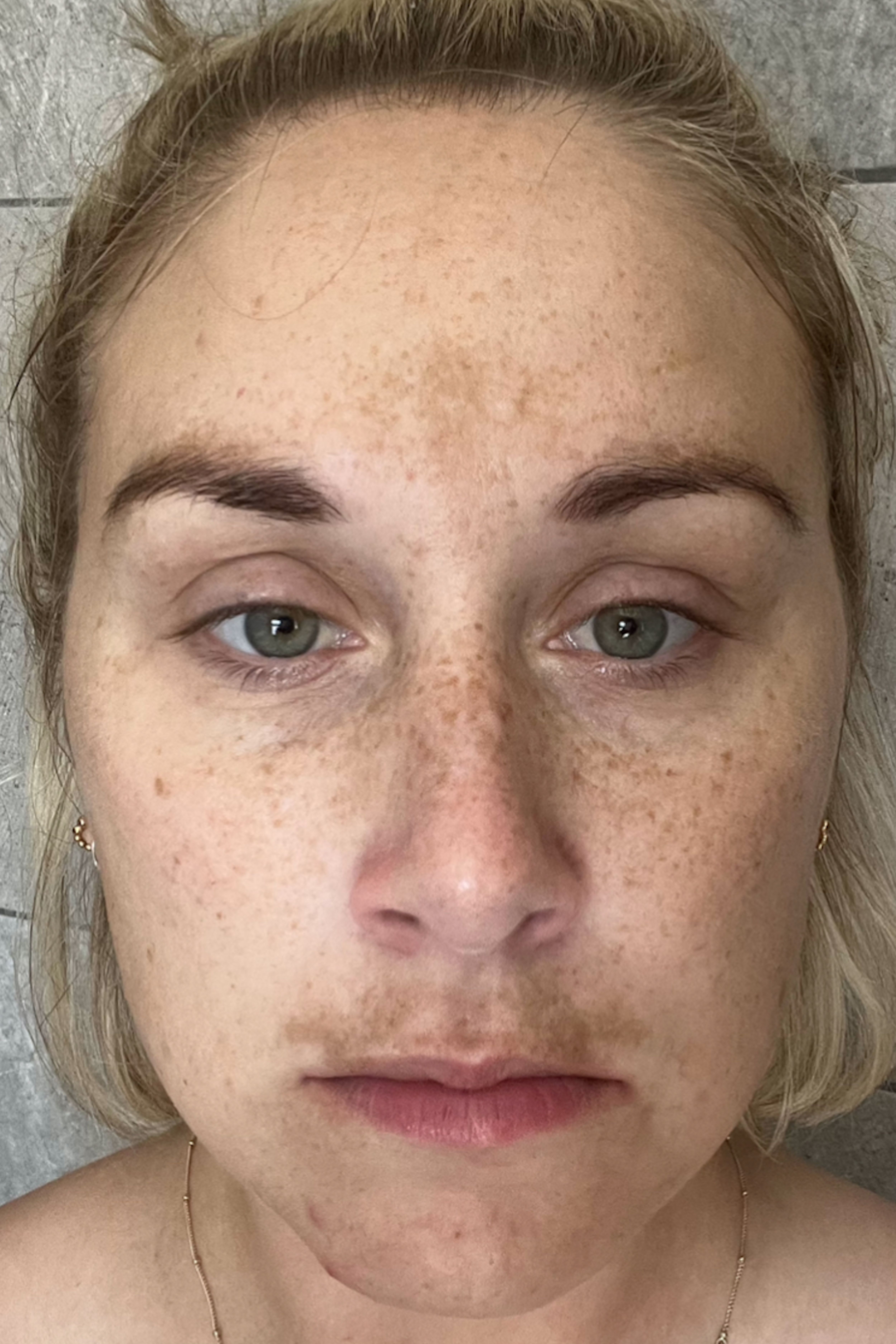 Pigmentation Skin Care | Creams, Serums & Cleansers | ESK