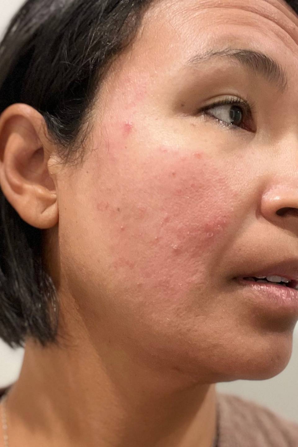 ESK Skincare Kits | Shop Our Skincare Kits Online - ESK