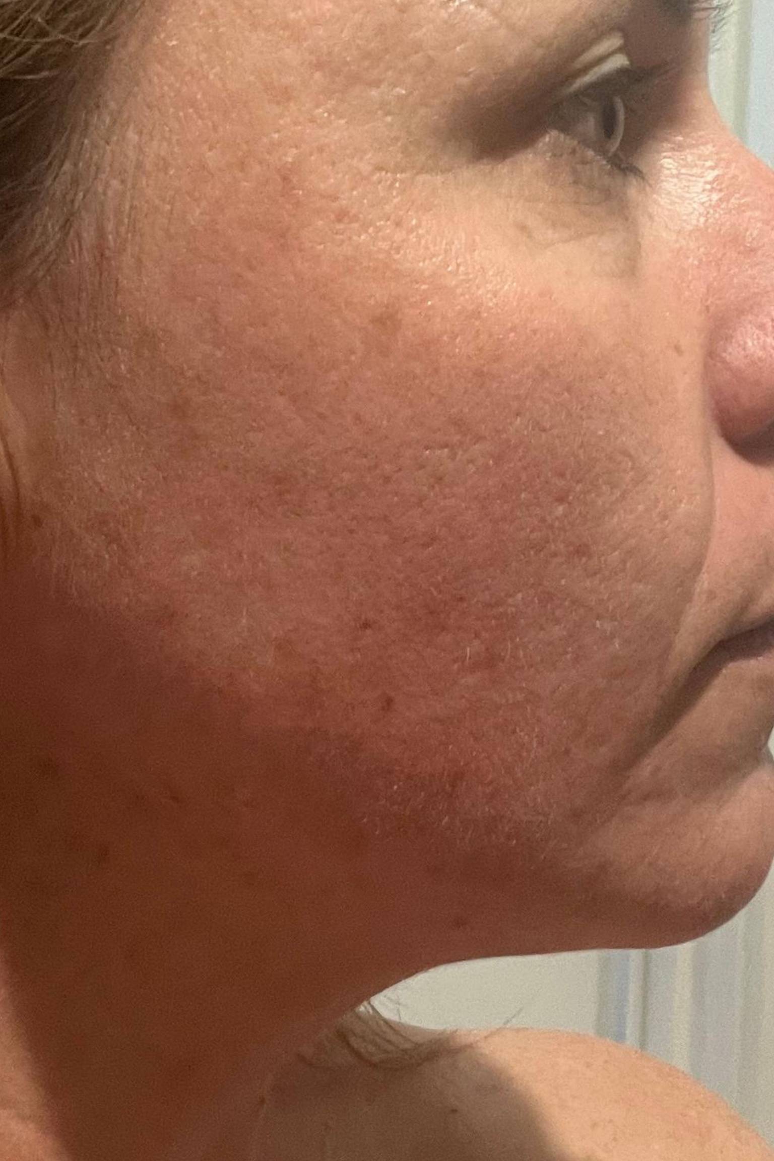 Pigmentation Skin Care | Creams, Serums & Cleansers | ESK