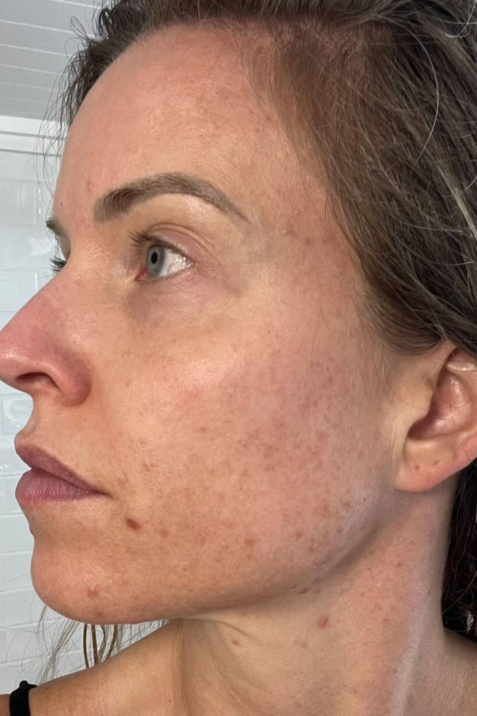 ESK Skincare Kits | Shop Our Skincare Kits Online - ESK