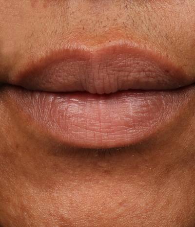 The Lip Plumping & Enhancing Regimen: Fill & Smooth – Ourself