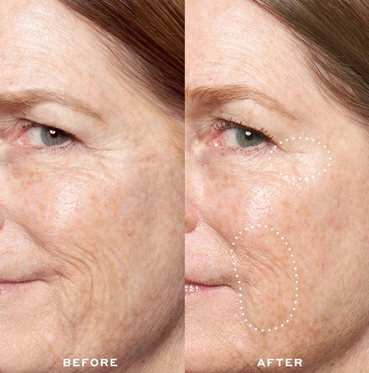 Double Rewind 0.3% Pro-Grade Retinol Serum