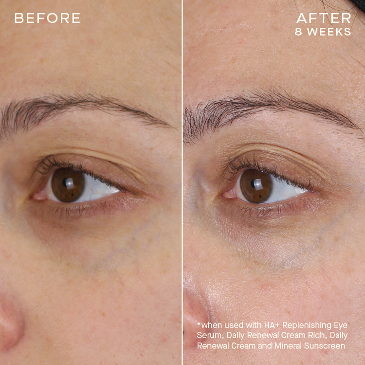 HA+ Replenishing Eye Serum – Ourself