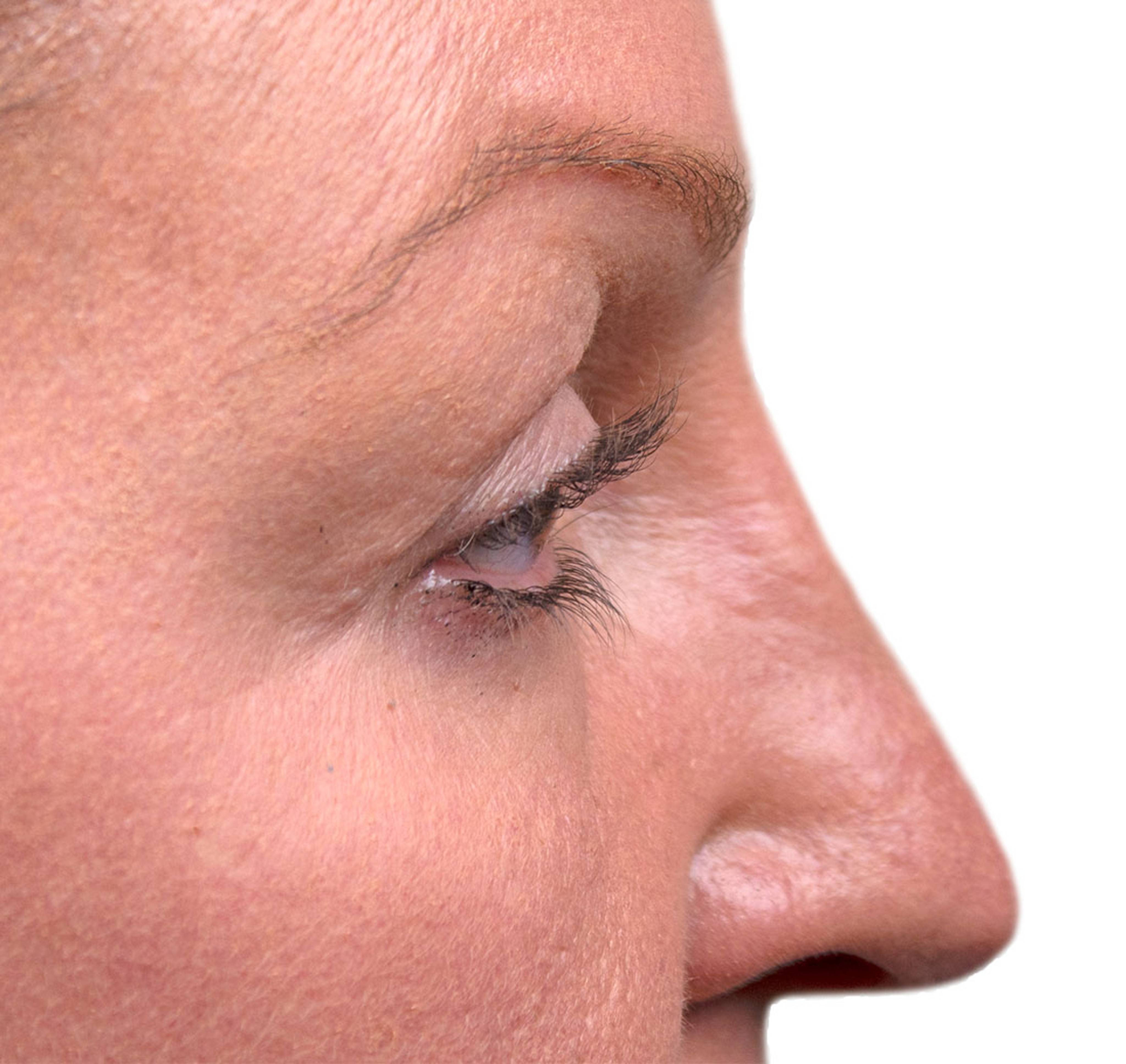 Medical Grade Lash Serum | Obagi Eyelash Enhancing Serum