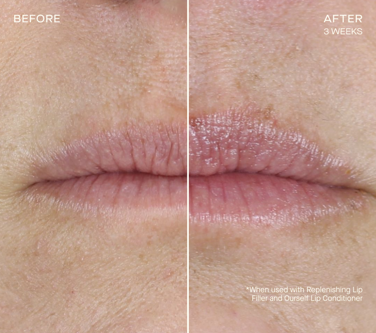 Natural Lip Filler With Plumping Hyaluronic Acid – Ourself
