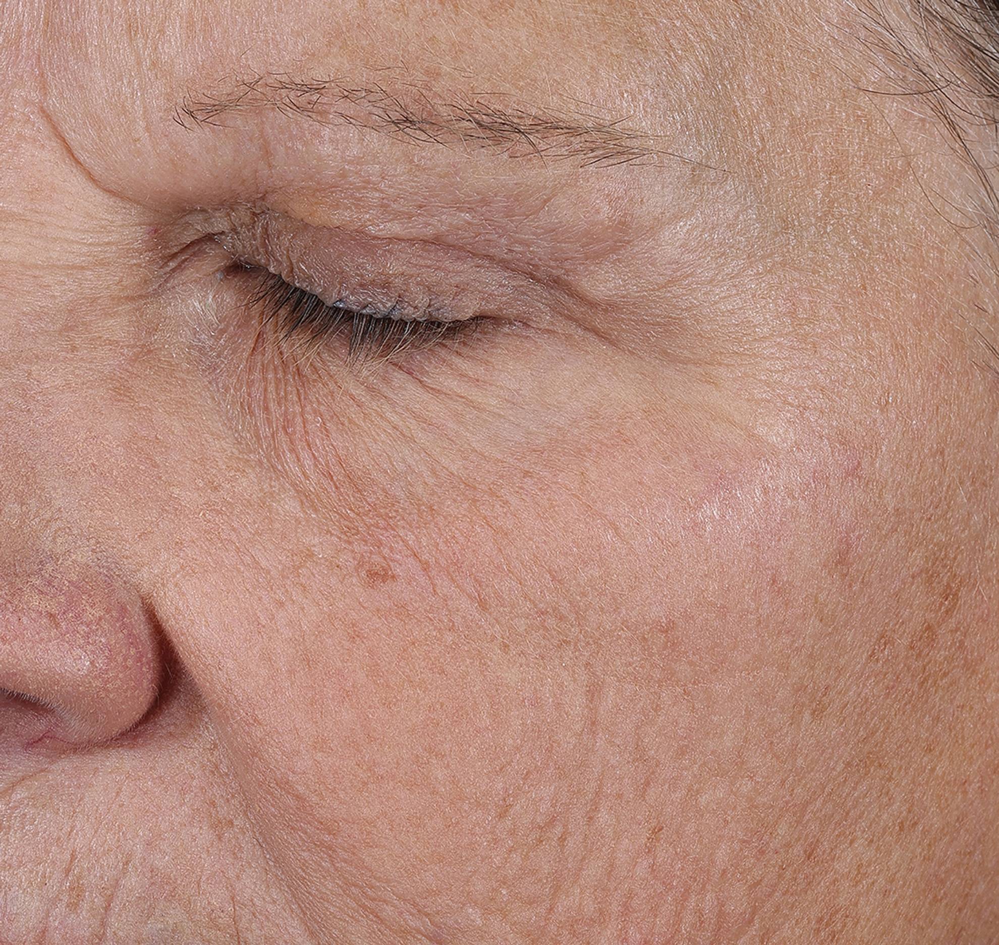 ELASTIDERM® Lift Up & Sculpt Face Moisturizer and Skin Tightening Cream | Obagi