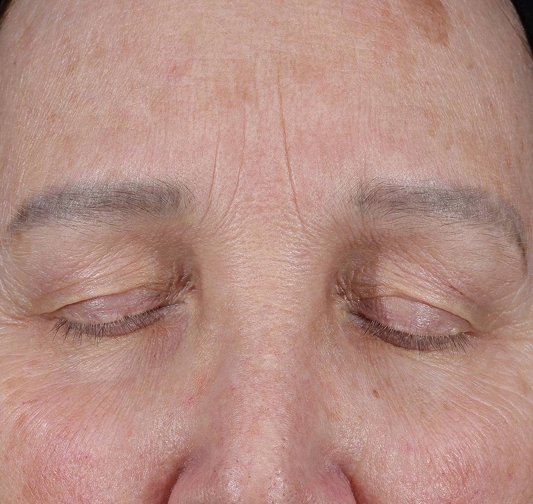 ELASTIDERM® Lift Up & Sculpt Face Moisturizer and Skin Tightening Cream ...